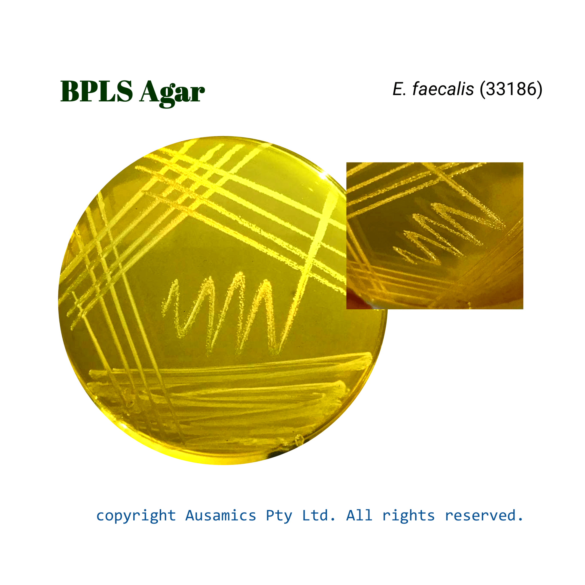 Brilliant-green Phenol-red Lactose Sucrose (BPLS) Agar | AuSaMicS